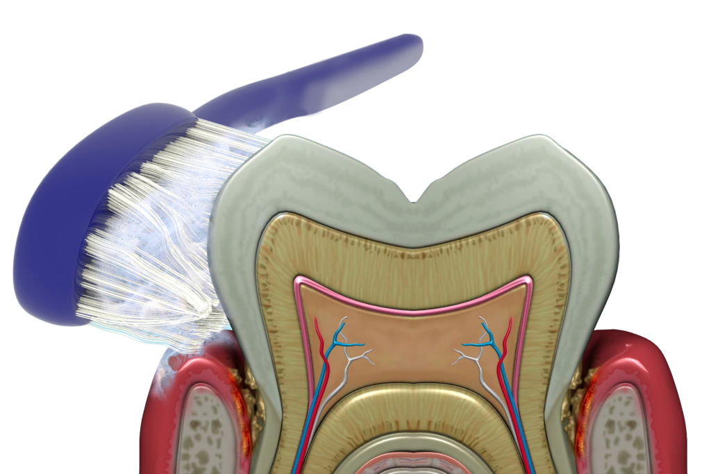 How It Works - Perio Protect